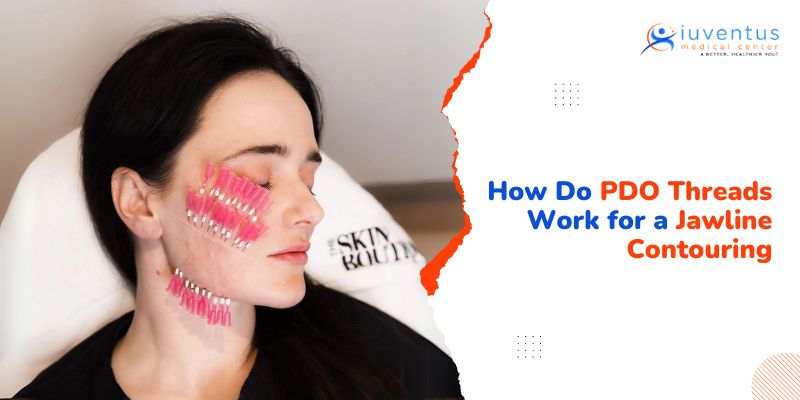 PDO Threads for Jawline Definition: Benefits Explained